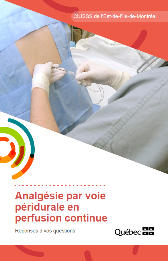 Analgésie par voie péridurale en perfusion continue | Bibliothèque ...