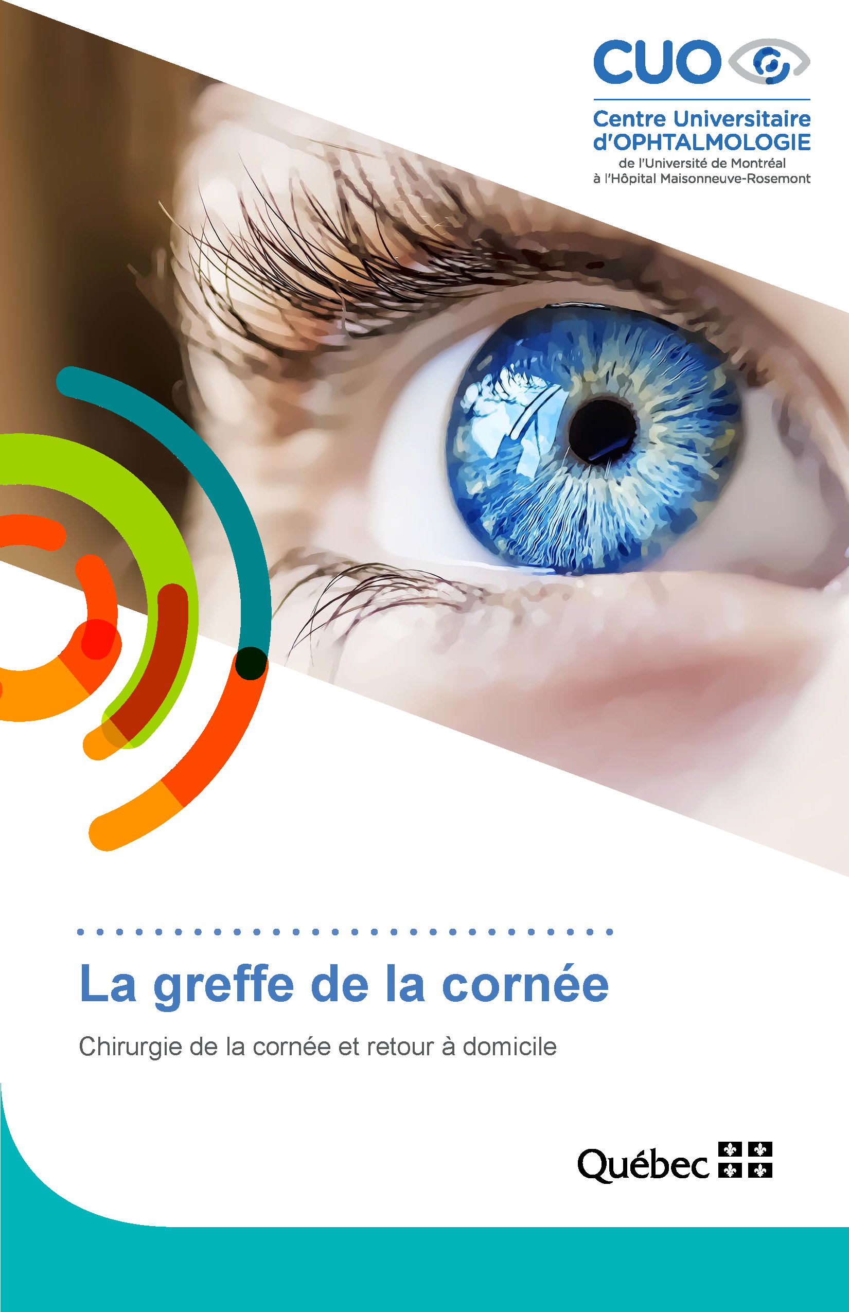 La greffe de la cornée: Chirurgie de la cornée et retour à domicile ...